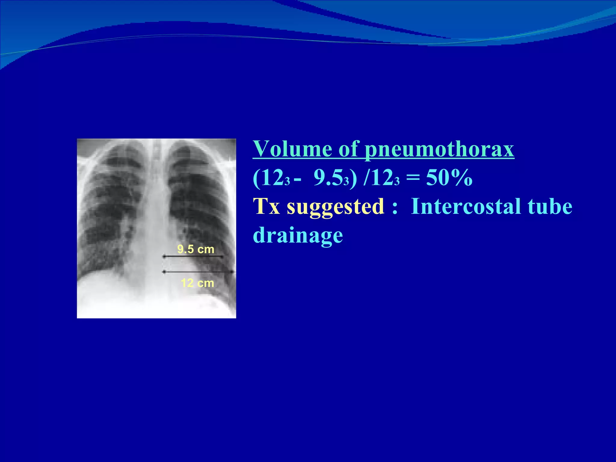 Spontaneous Pneumothorax An Update | PPT