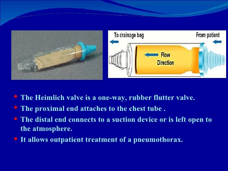 Spontaneous Pneumothorax An Update