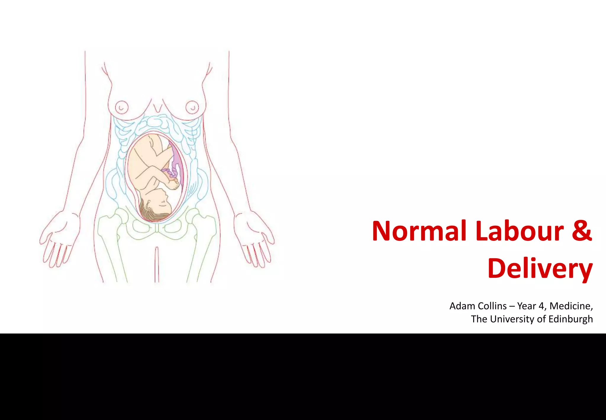 Spontaneous Vertex Delivery - Normal Childbirth | PPTX