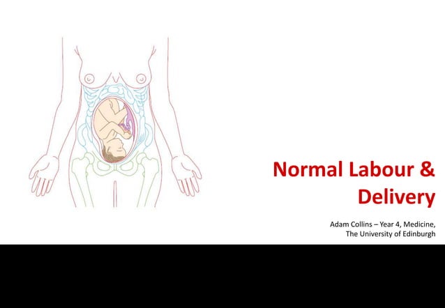 Spontaneous Vertex Delivery - Normal Childbirth | PPTX | Pregnancy | Reproductive Health