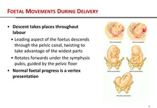 Spontaneous Vertex Delivery - Normal Childbirth | PPT