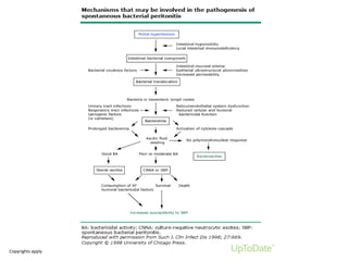 Spontaneous Bacterial Peritonitis (SBP) | PPTX