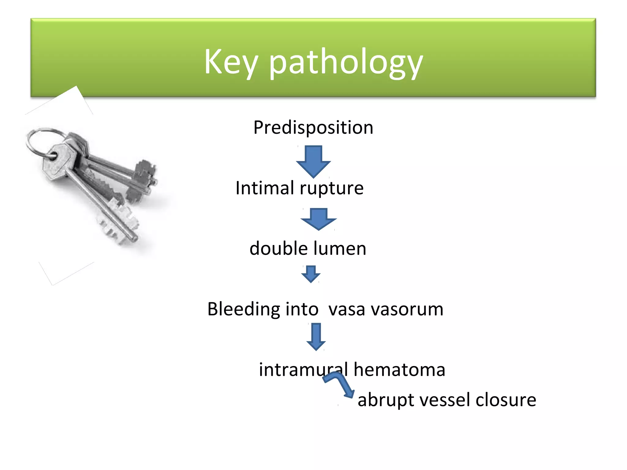 Spontaneous coronary artery dissection | PPT Spontaneous coronary artery dissection | PPT