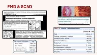 Spontaneous Coronary Artery Dissection (SCAD) | PDF