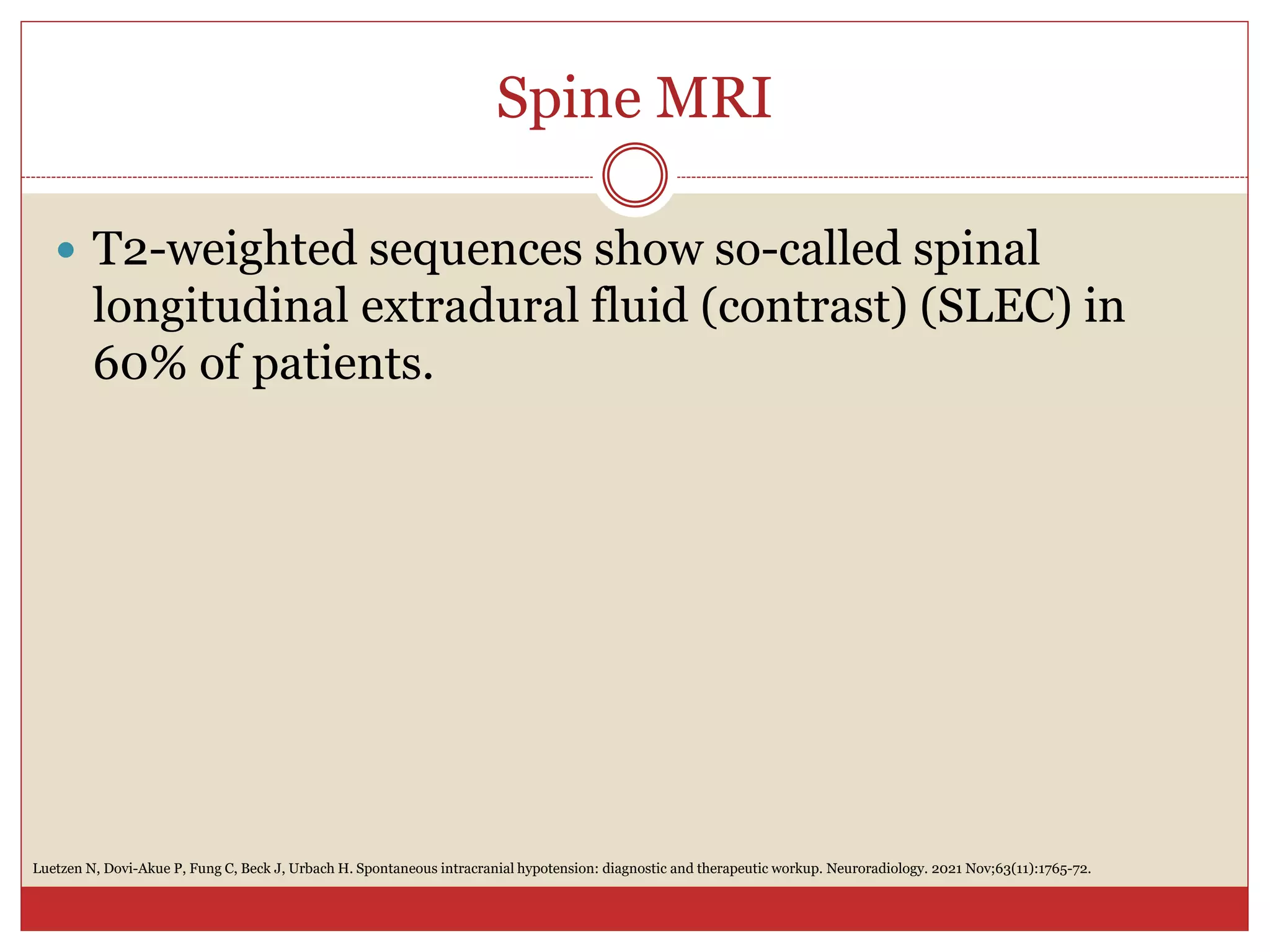 Spontaneous Intracranial Hypotension.pptx