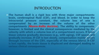 Spontaneous intracranial hypotension (sih) | PPTX | Brain and Nervous ...