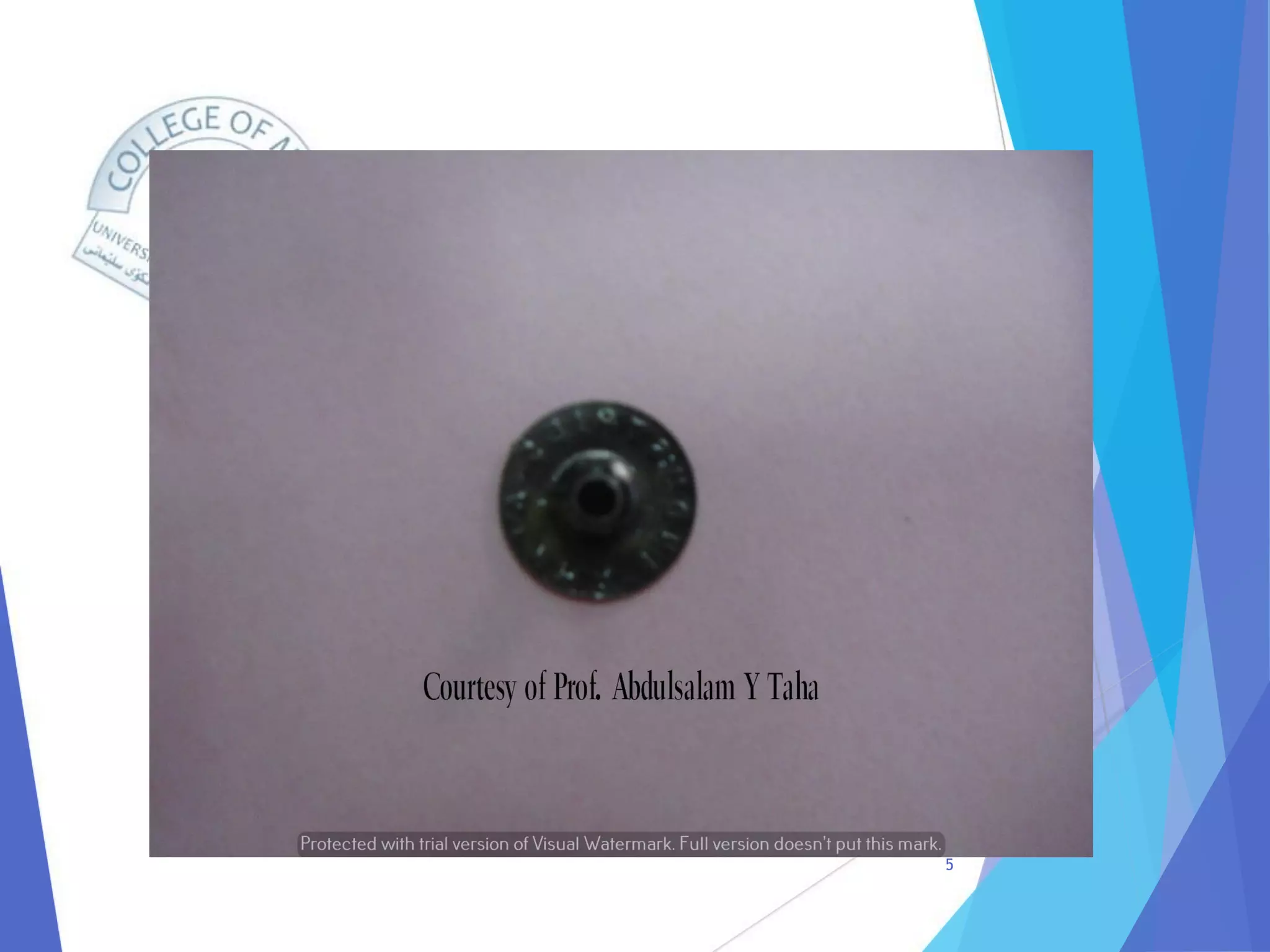 Spontaneously Expectorated Foreign Body.pdf