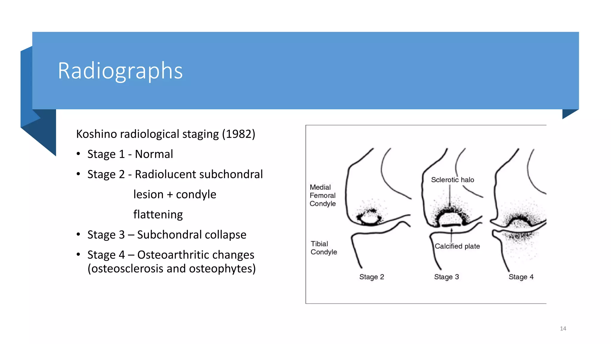 Spontaneous Osteonecrosis of the Knee.pptx