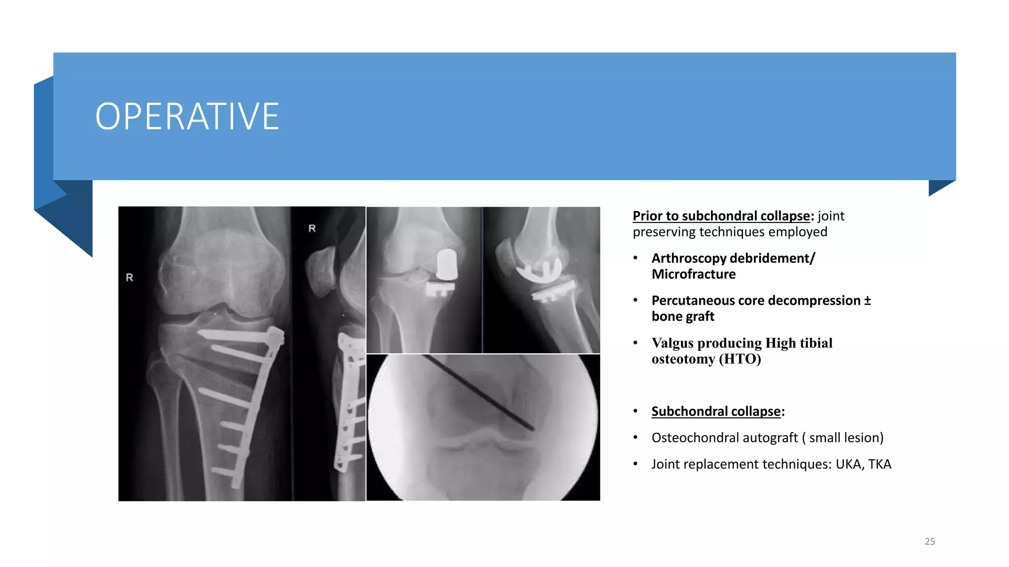 Spontaneous Osteonecrosis of the Knee.pptx