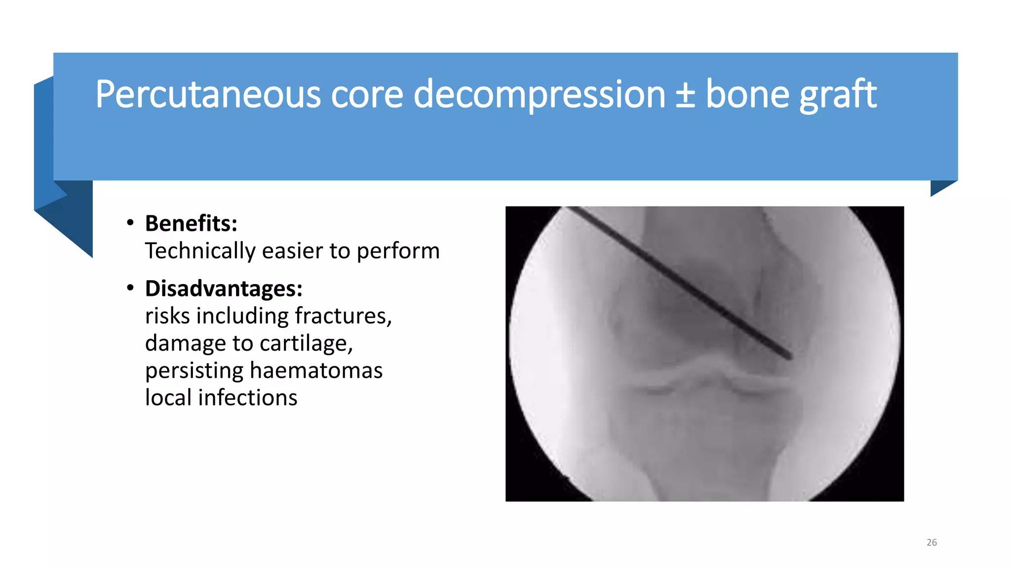 Spontaneous Osteonecrosis of the Knee.pptx