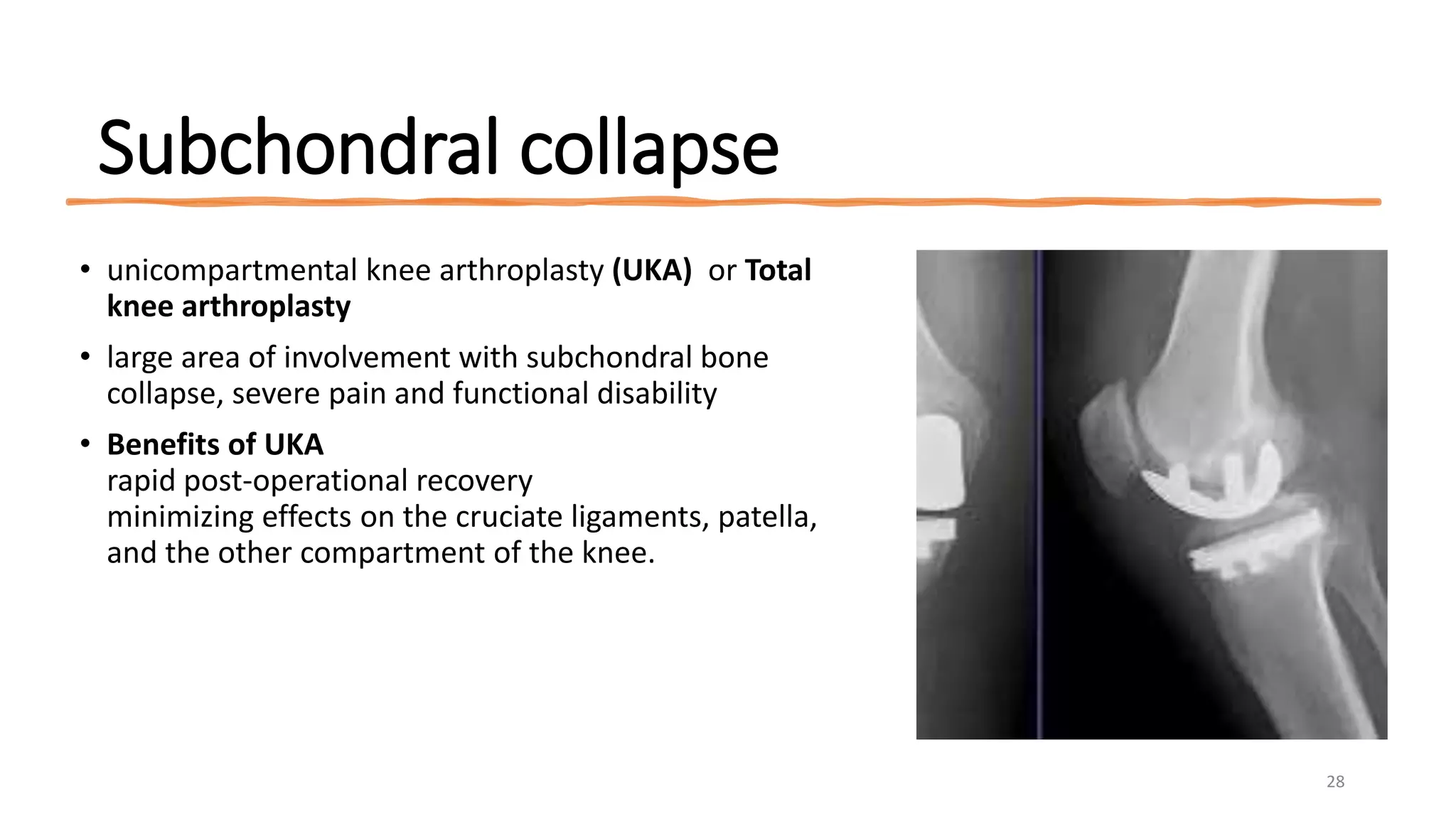 Spontaneous Osteonecrosis of the Knee.pptx