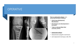 Spontaneous Osteonecrosis of the Knee.pptx