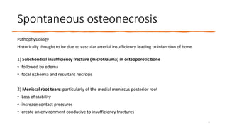 Spontaneous Osteonecrosis of the Knee.pptx
