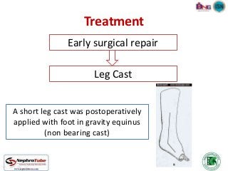 End Stage Renal Disease Patient With Spontaneous Tendo-Achilles Rupture ...