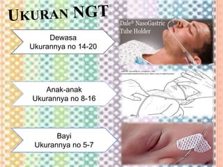 SPO pemasangan NGT | PPTX