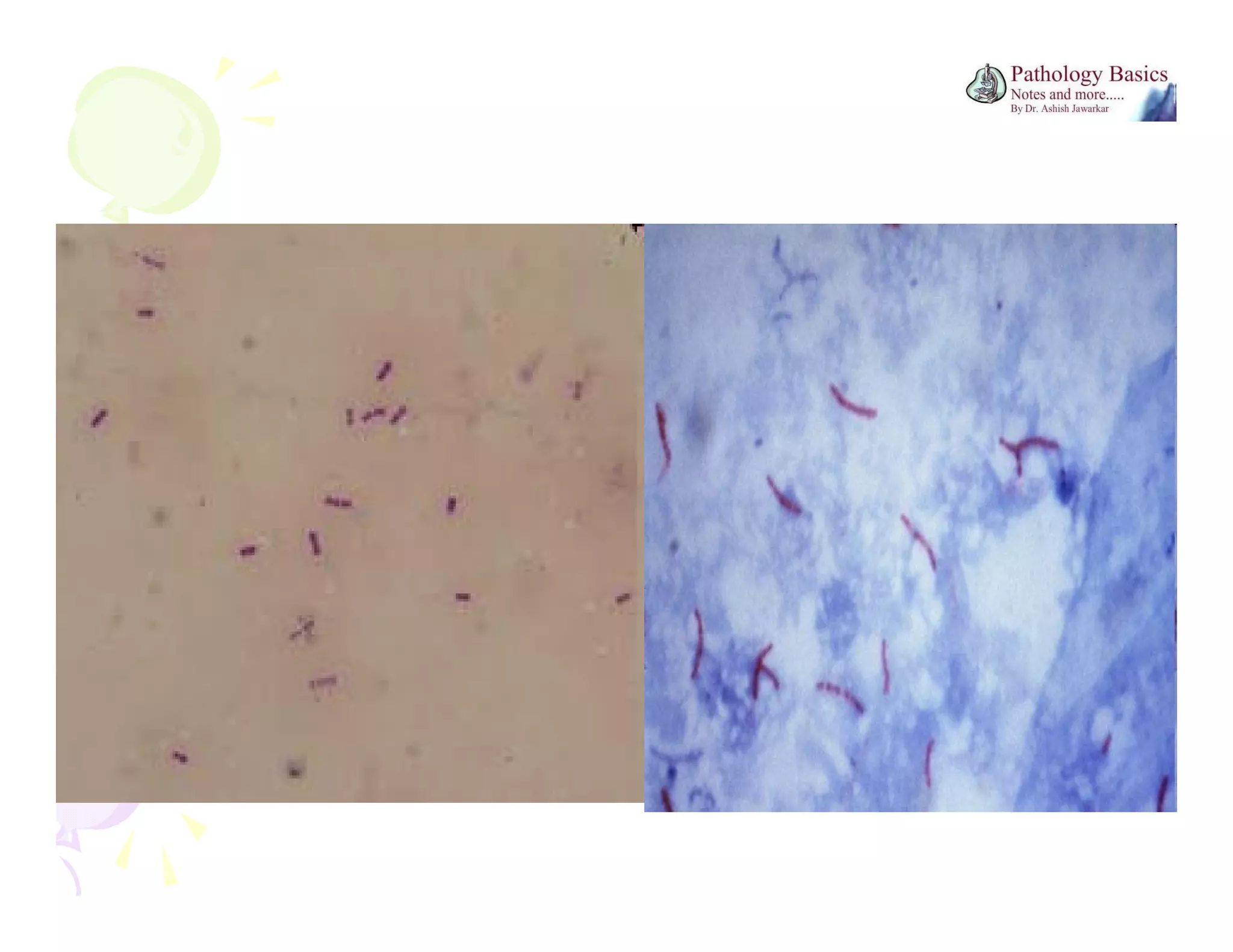 Spore forming bacteria - bacillus and clostridia | PDF