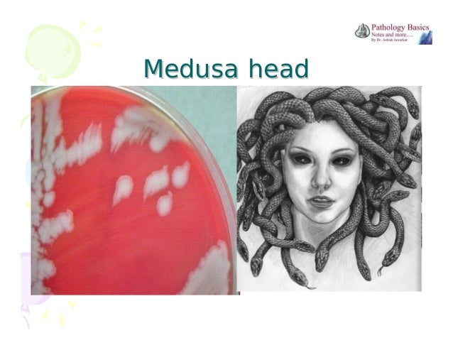 Spore forming bacteria - bacillus and clostridia