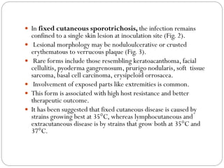 Sporotrichosis | PDF