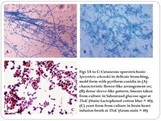 Sporotrichosis | PPT