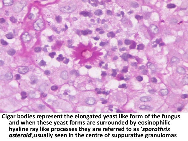 Sporotrichosis & chromoblatomycosis