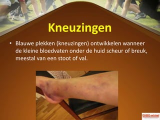 Sportblessures types en ziektes te voorkomen. | PPTX
