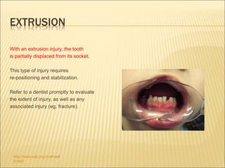 Sport Dentistry.ppt