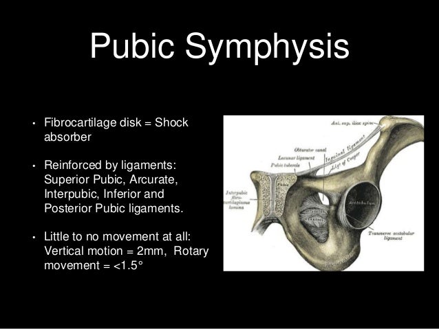 Treatment Of Hip Flexion Contractures With Psoas Recession