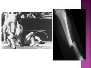 Sport Injuries - Ankle and Lower Leg Injuries | PPTX
