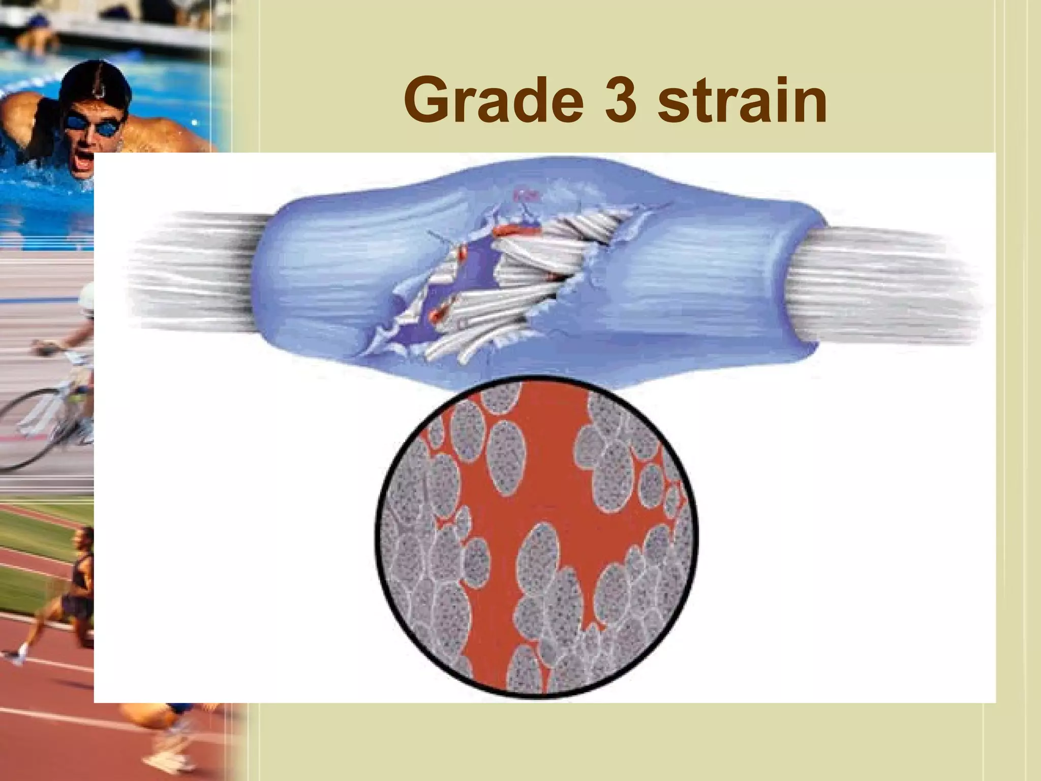 Sport injuries physiological resposes (muscle strain) | PPT