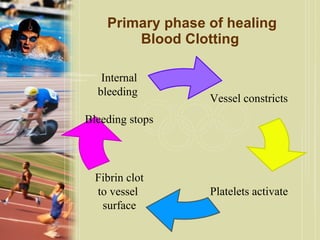 Sport injuries physiological resposes (muscle strain) | PPT