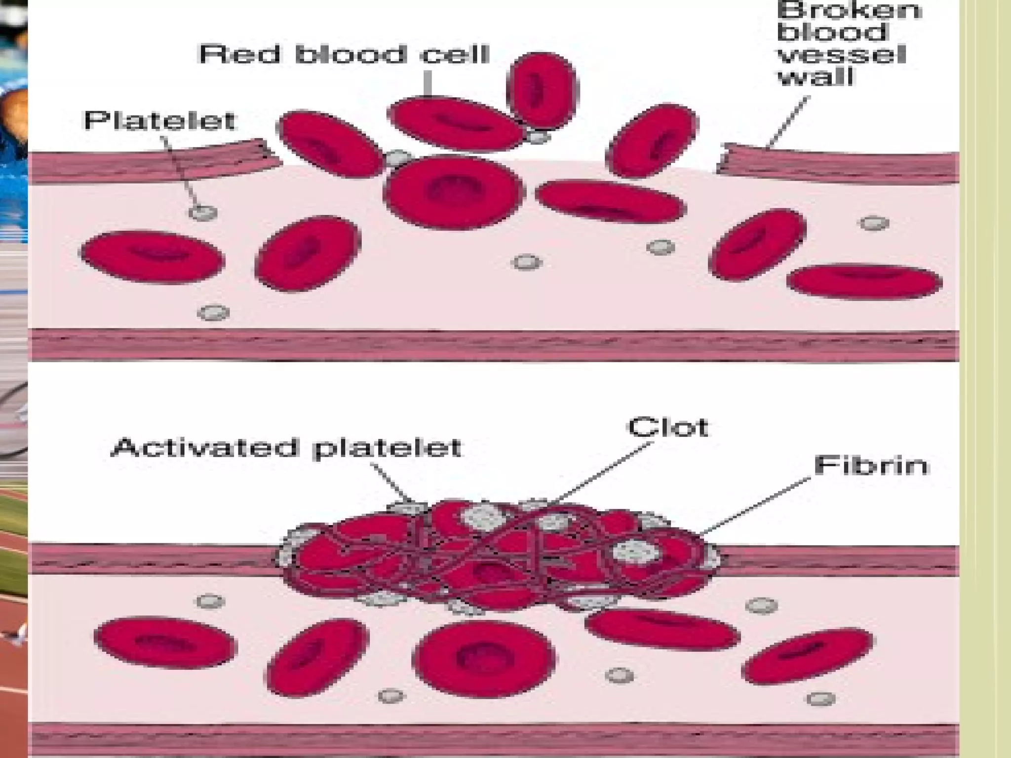 Sport injuries physiological resposes (muscle strain) | PPT