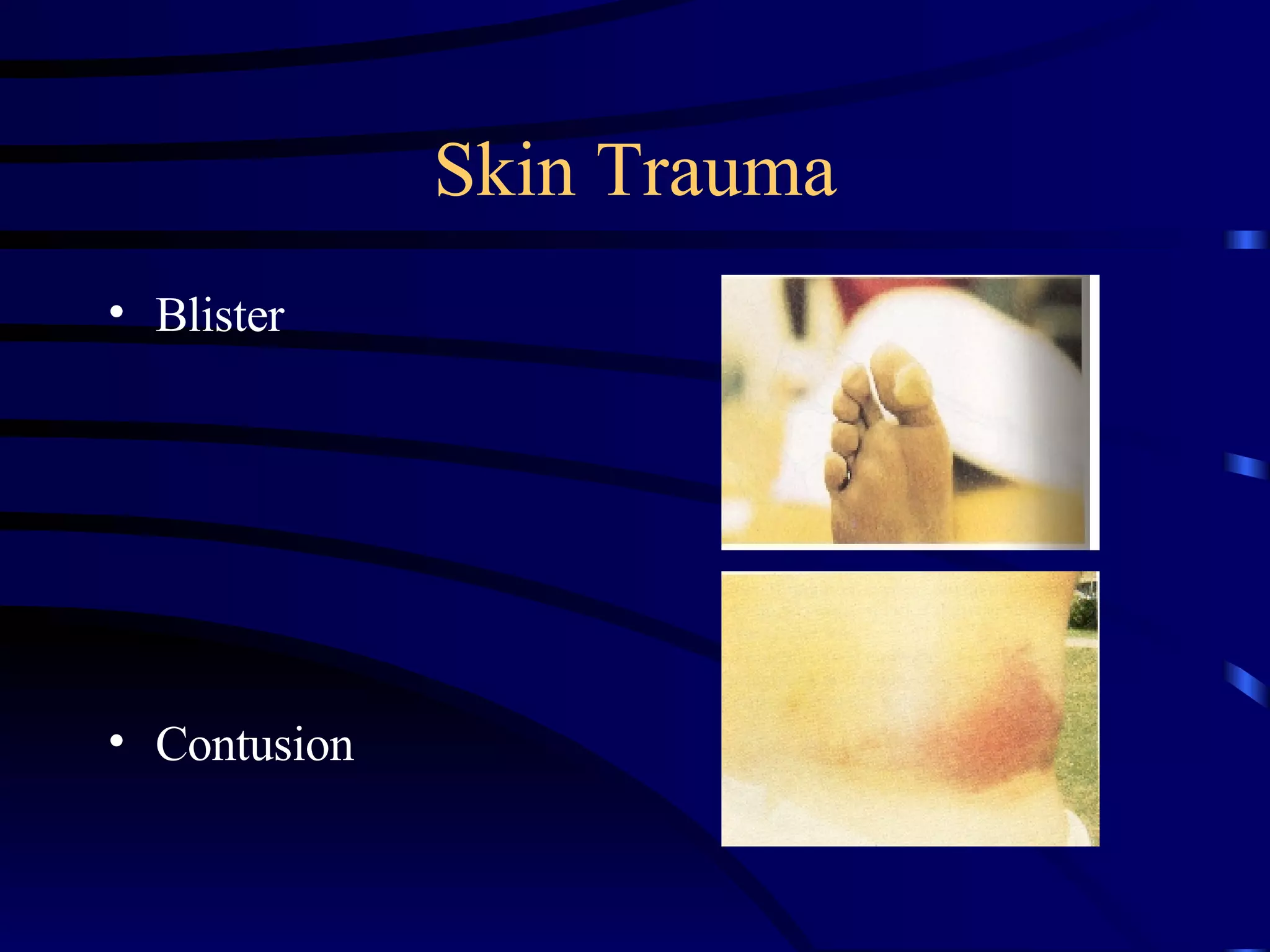 Sports Injuries An Overview | PPT | Death, Injury, or Military Conflict ...