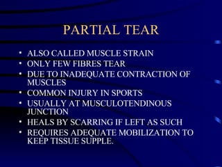 Sports Injuries An Overview | PPT