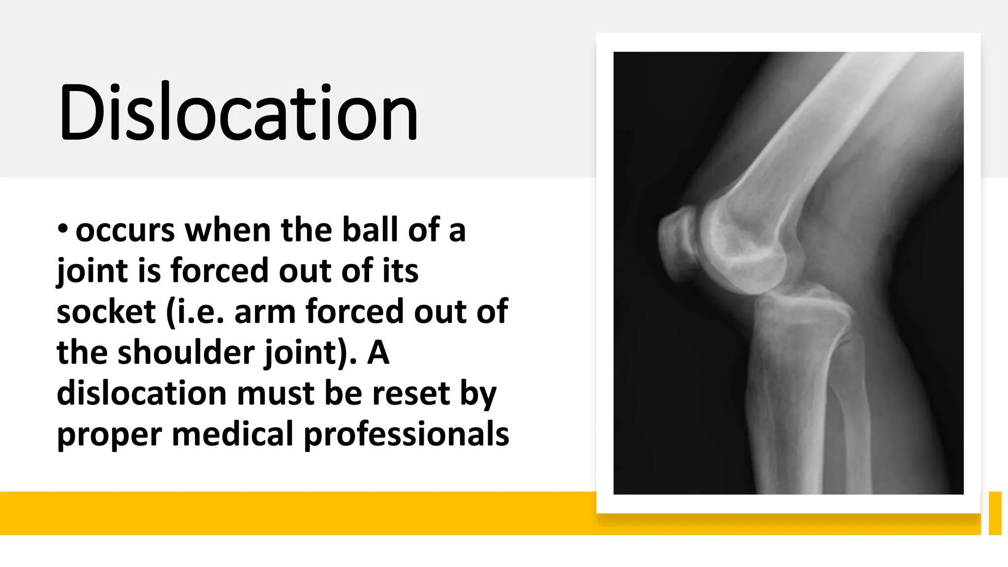 Sports-Related-Injuries-.pptxfrommapehgrade10 | PPTX | Death, Injury ...