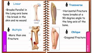Sports injuries | PPTX