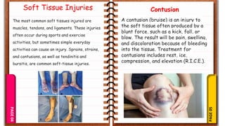 Sports injuries | PPTX