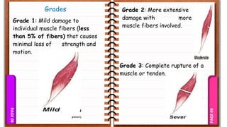 Sports injuries | PPTX