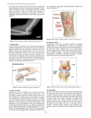 sports injuries..pdf