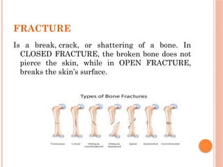 Sports Injuries and Prevention of Sports Injuries | PPTX