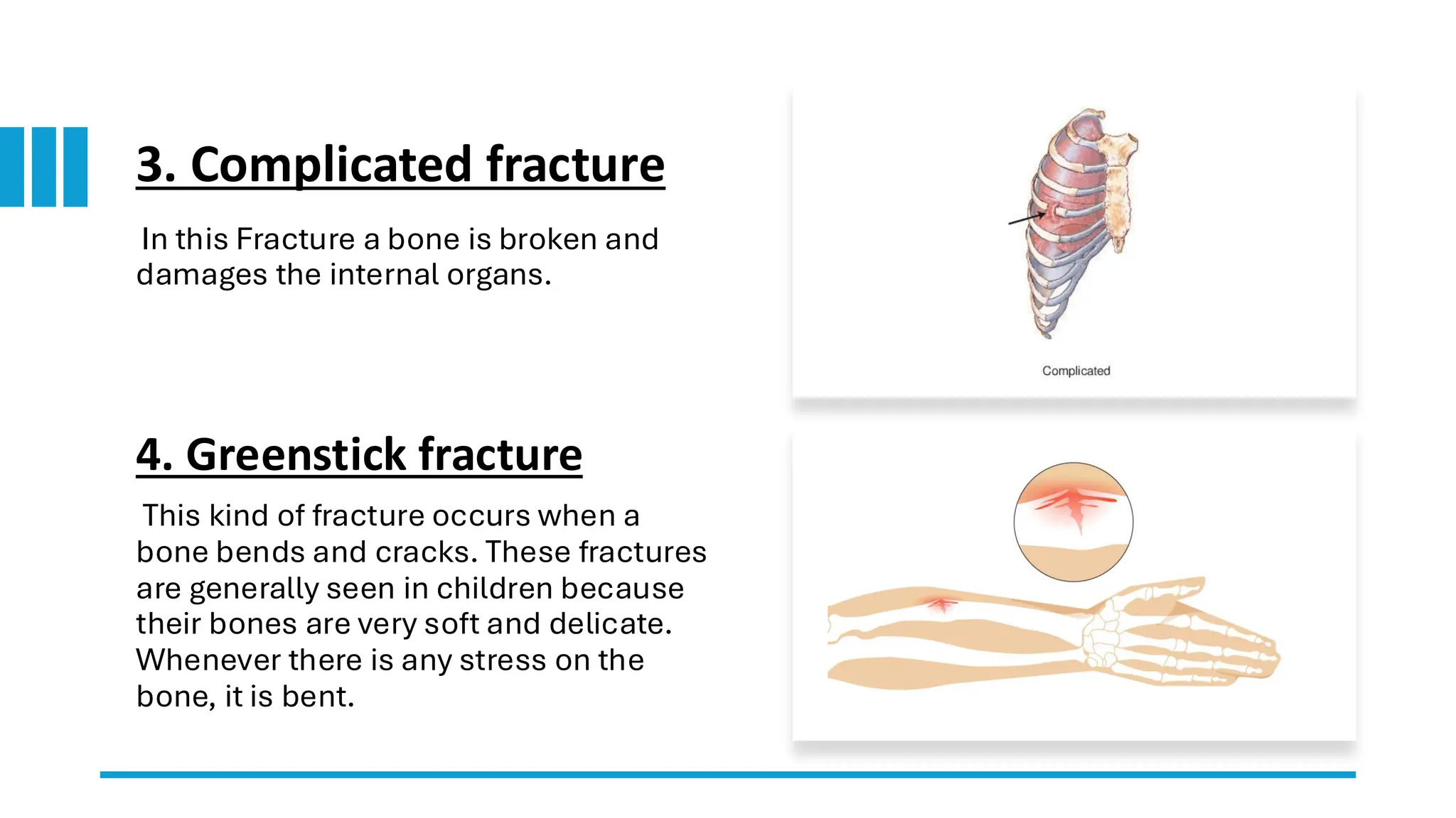 sports injuries class 12 physical education cbse.pdf