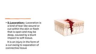 sports injuries class 12 physical education cbse.pdf