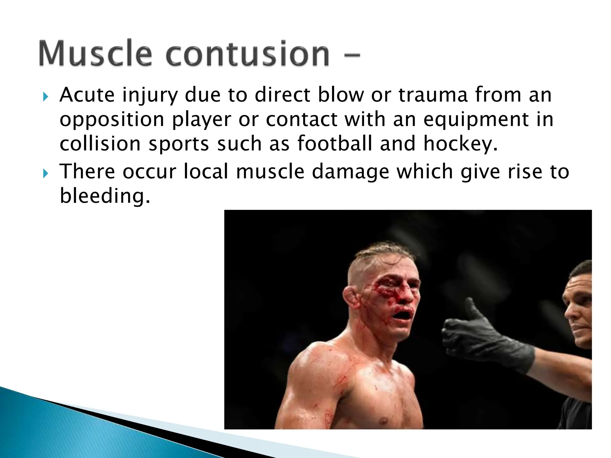 Sports Injuries(Classification).pptx