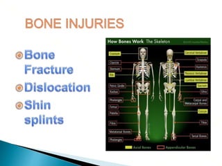 Sports Injuries(Classification).pptx