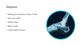 SPORTS INJURIES OF ANKLE AND FOOT original.pptx