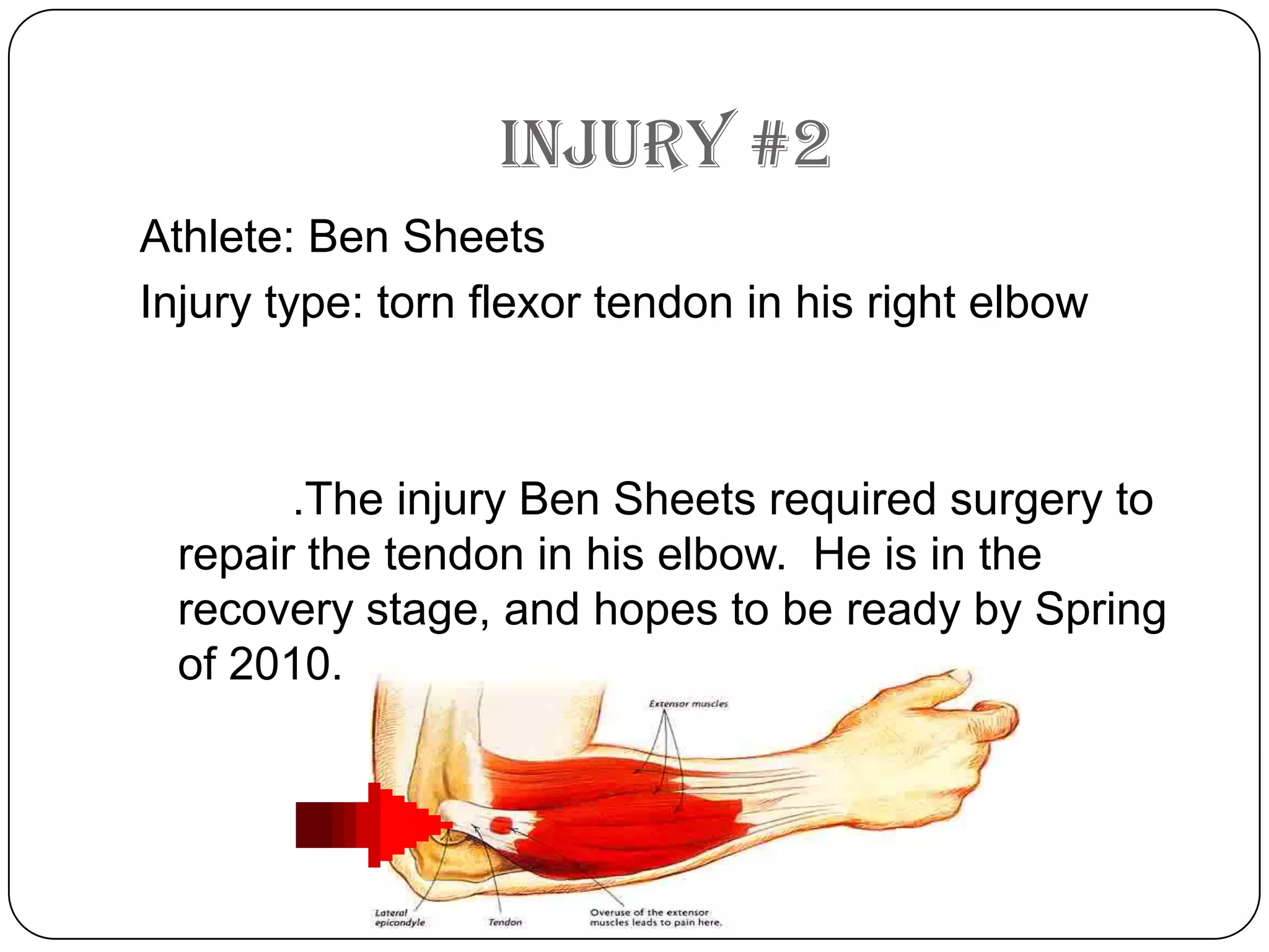 Sports Injuries Presentation | PPTX