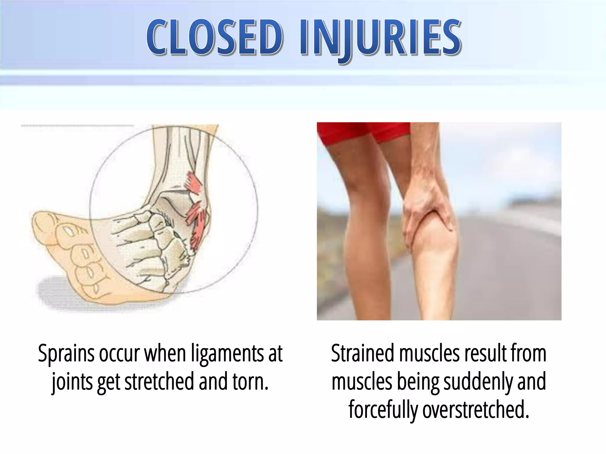 Sports Injury | PDF
