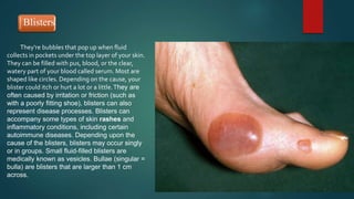 common Sports injuries | PPTX