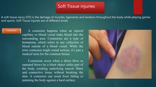 common Sports injuries | PPTX