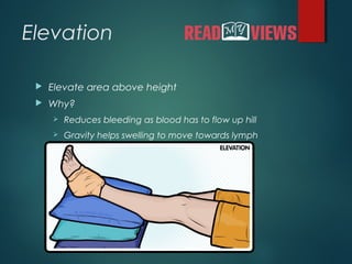 Sports injury management | PPT