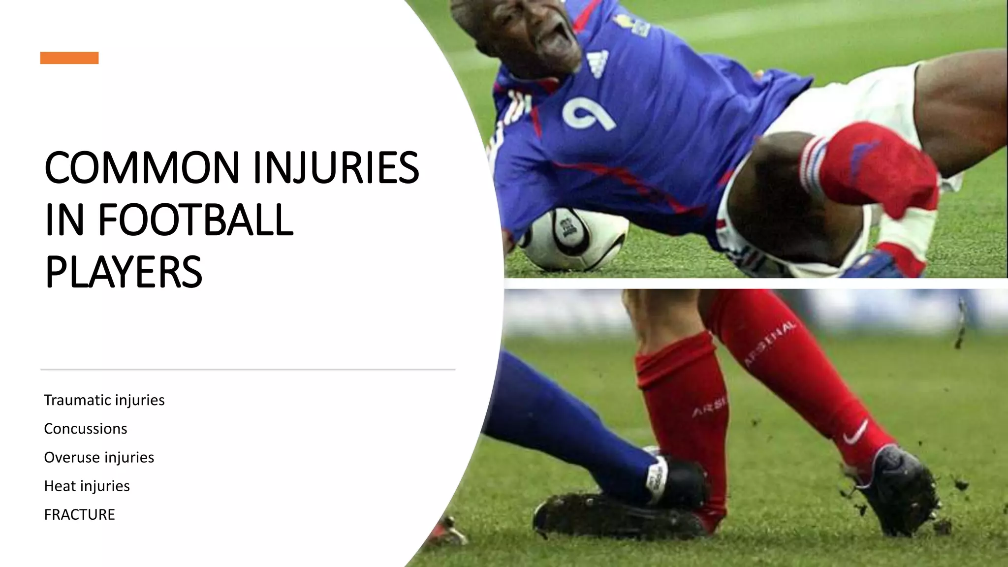 Sports injury & Prevention | PPTX